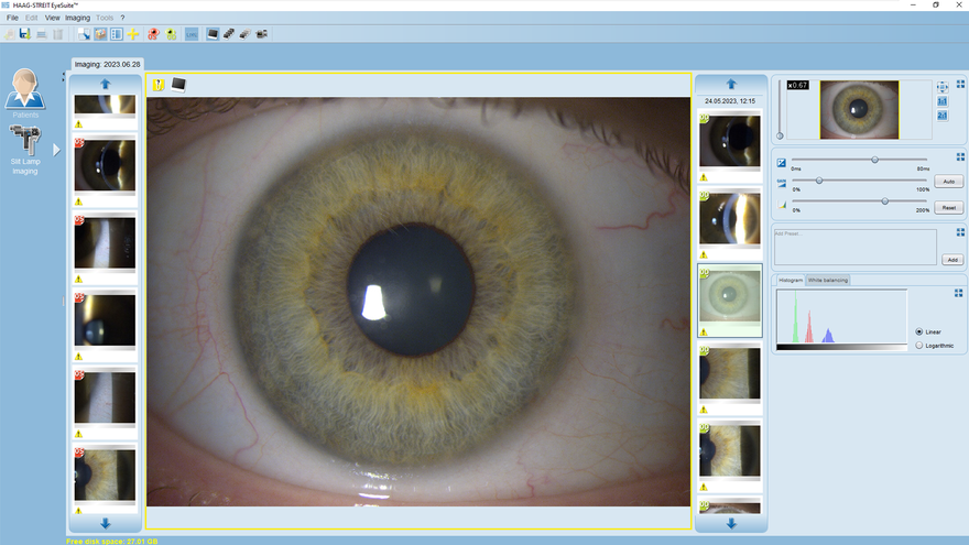 Slit lamp imaging